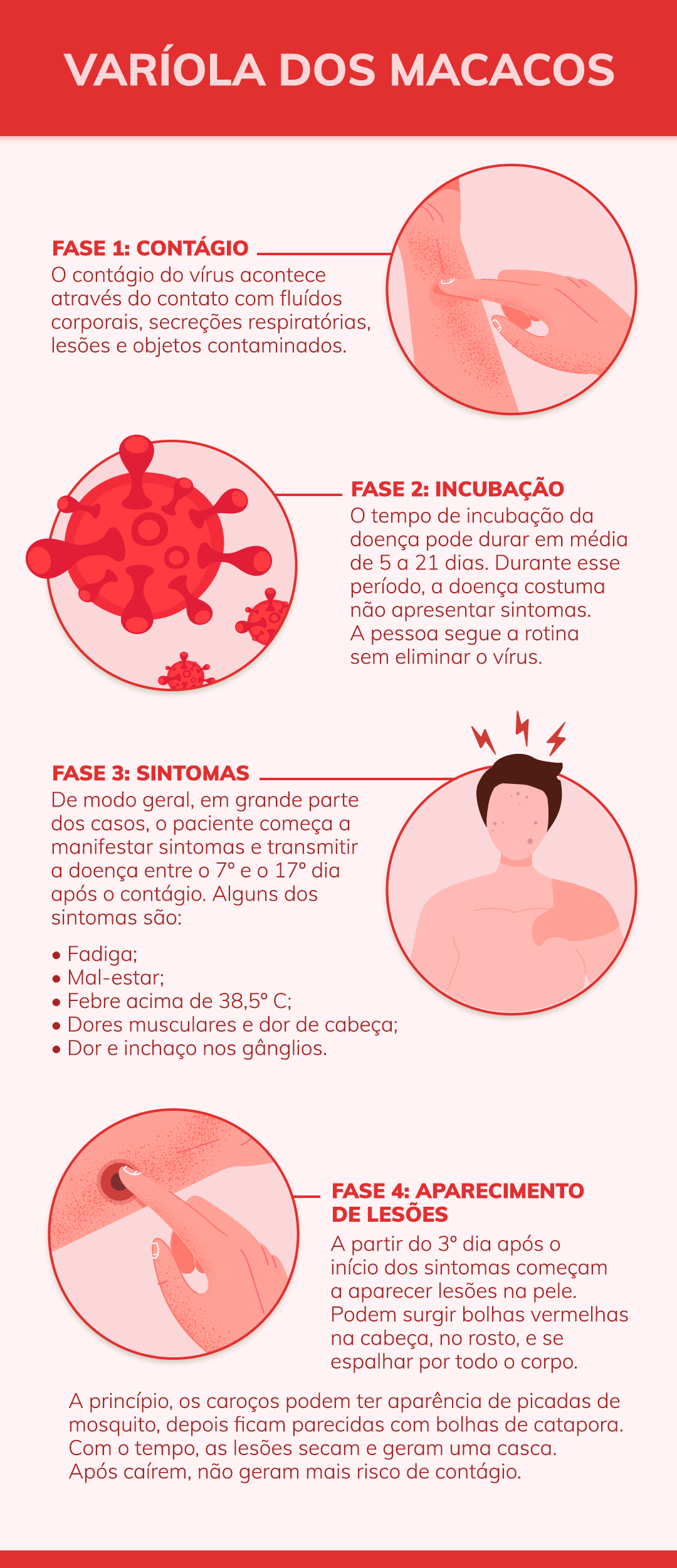 Varíola dos Macacos | Entenda os principais sintomas