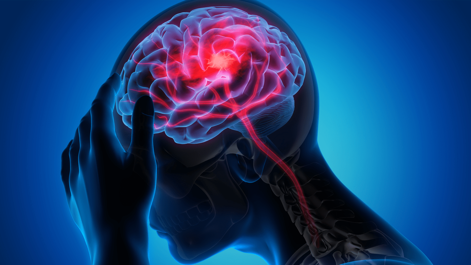 AVC | Quais os principais sintomas e fatores de risco?