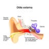 O que preciso saber sobre Otite Externa?